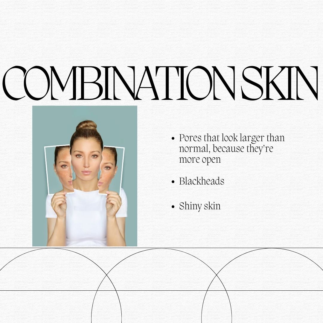 The Truth About Combination Skin – What It Really Means